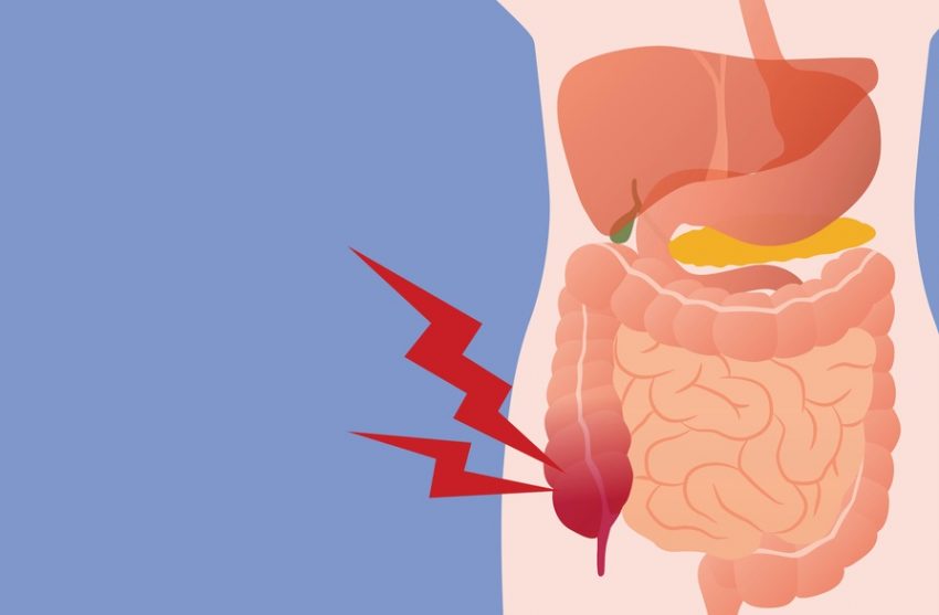Apendicitis: localización y síntomas - Consejo al Día